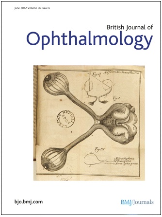 Eye Cite Editing - Portfolio